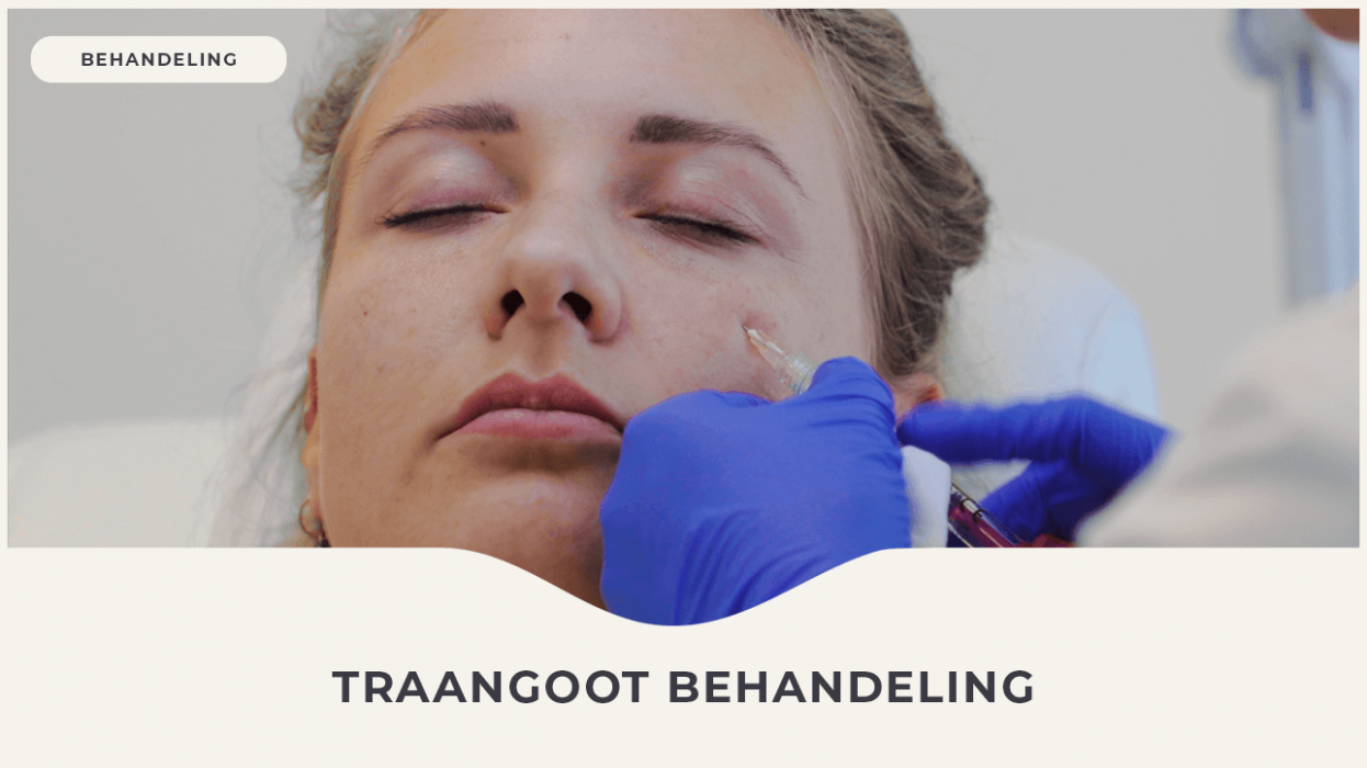 Traangoot filler voor €390,- | Face your beauty | Faceland